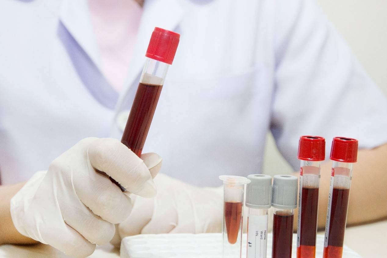 Medical Device Immunogenicity Test Services | CD Bioparticles